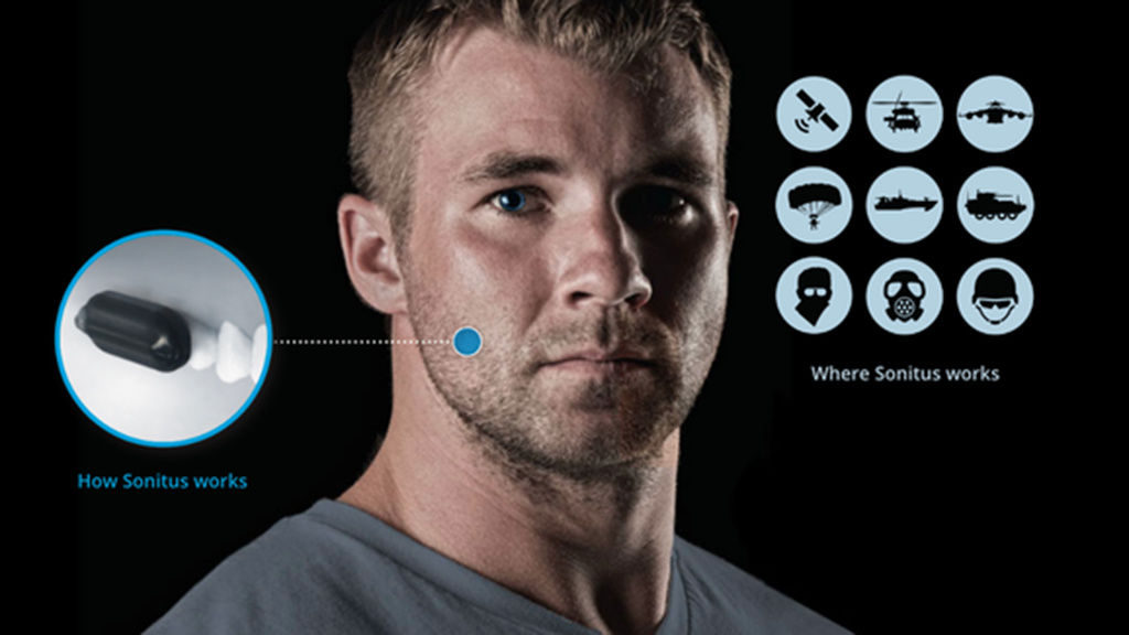 Molar Mic: US-Armee investiert Millionen in Backenzahn-Mikrofon ...