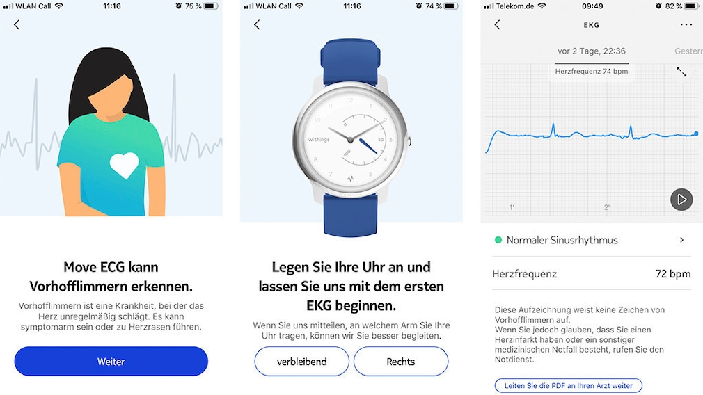 Withings Move ECG: Erster Test, Details, Infos - COMPUTER BILD