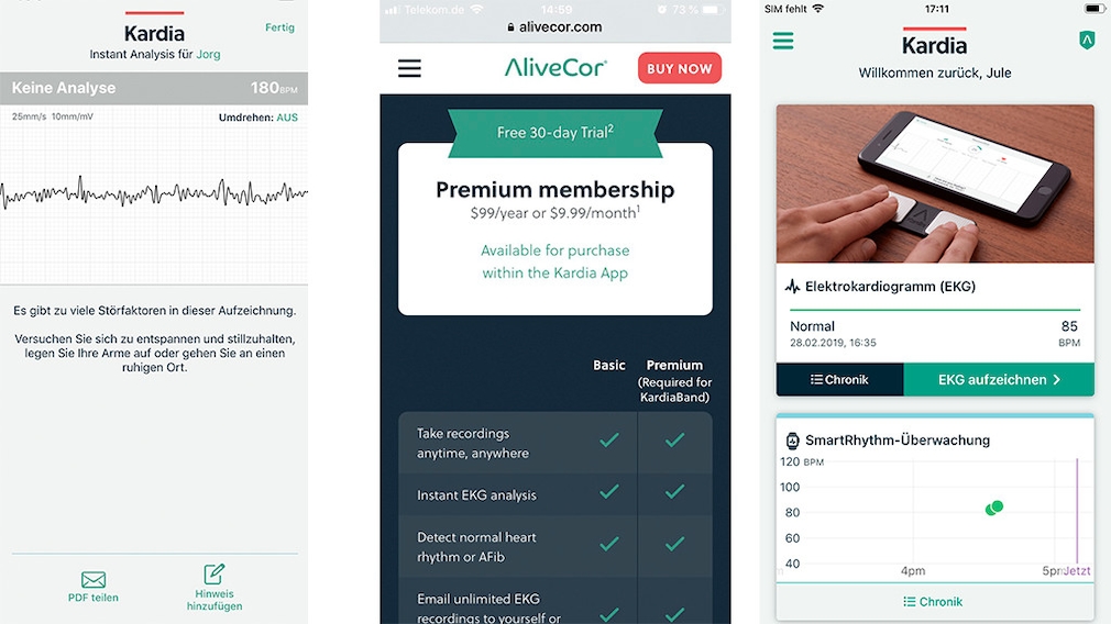 AliveCor Kardia Mobile: EKG-Gerät im Test - COMPUTER BILD