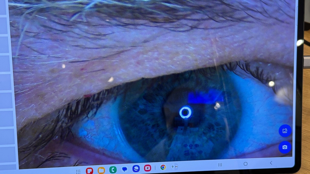 Cat Eye: Telefónica zeigt KI-Technik gegen Grauen Star - COMPUTER BILD