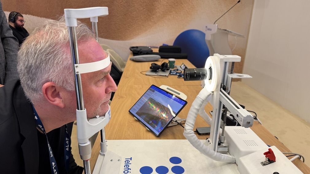 Cat Eye: Telefónica zeigt KI-Technik gegen Grauen Star - COMPUTER BILD